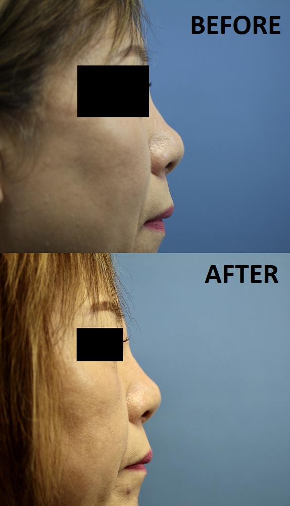 Nonsurgical Treatments - Jae Kim, MD