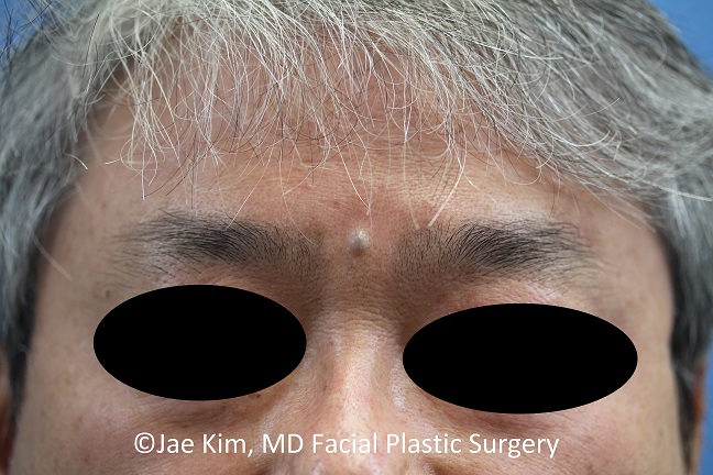 Before & After - Jae Kim, MD